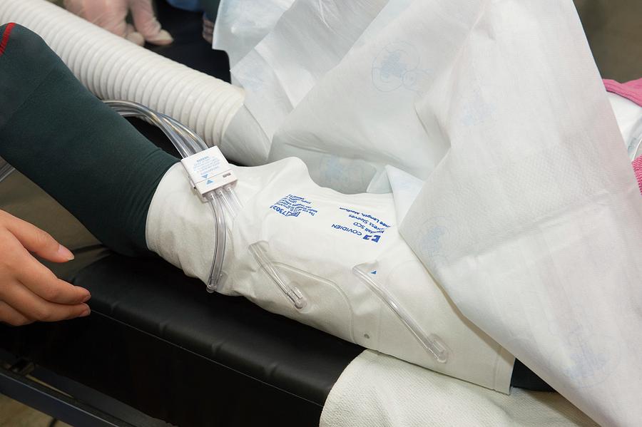 Sequential Compression Device Photograph by Dr P. Marazzi/science Photo ...