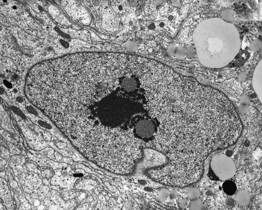 Sertoli Cell Tem Photograph By Science Photo Library Pixels