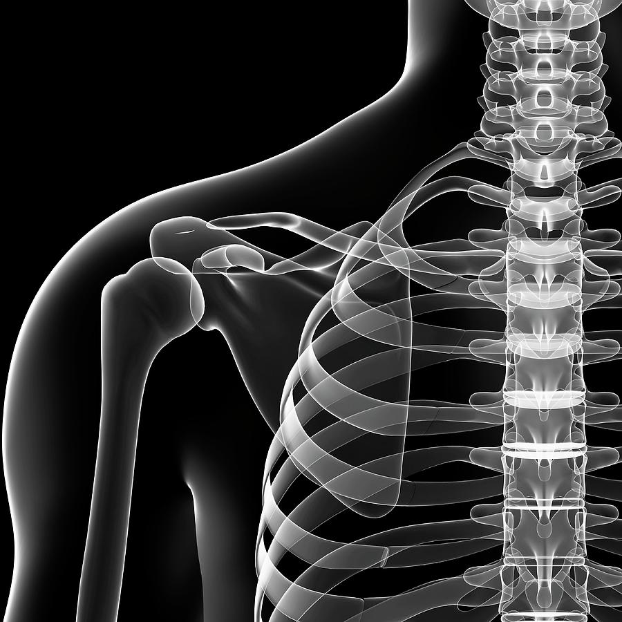 Shoulder Bones Photograph by Pixologicstudio/science Photo Library - Pixels