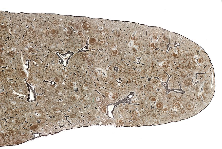 Spleen by Science Photo Library