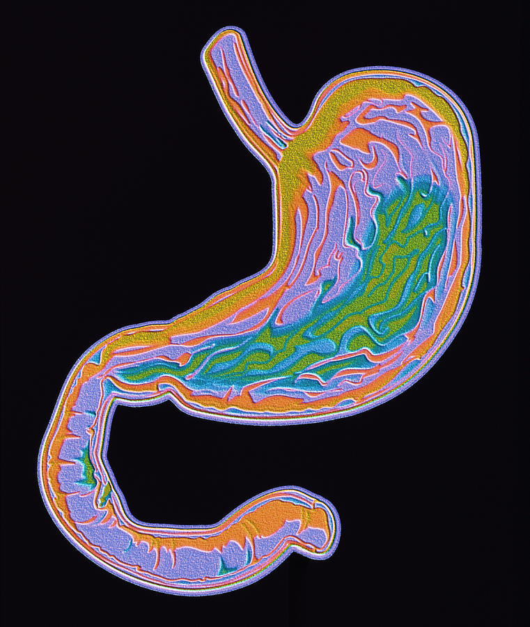 Stomach Photograph by Alfred Pasieka/science Photo Library
