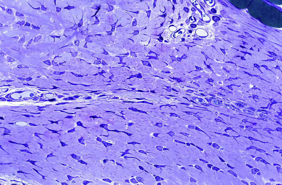 Tendon Photograph by Microscape/science Photo Library - Fine Art America