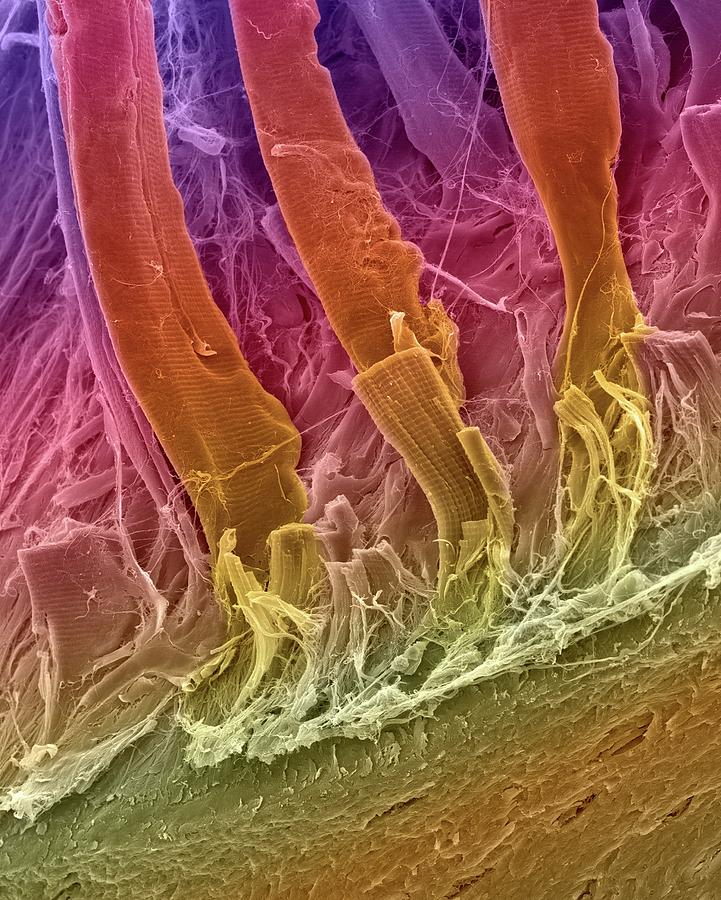 Tendons Attached To Bone Surface Photograph by Science Photo Library ...