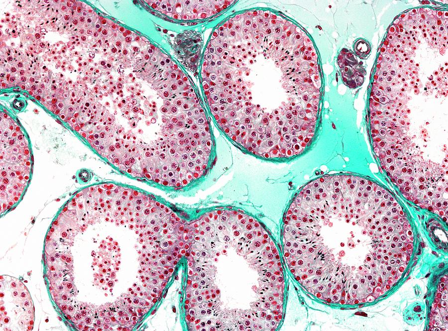 Testis Photograph by Science Photo Library - Fine Art America