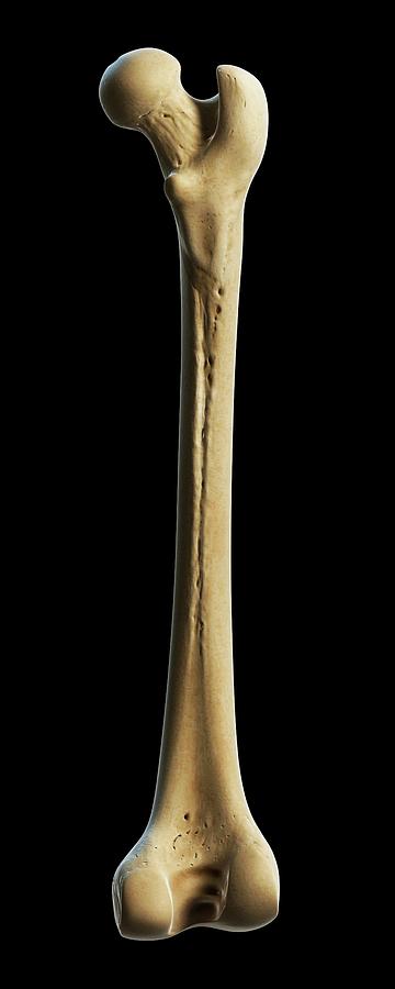Thigh Bone by Science Photo Library