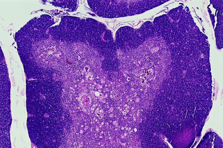 Thymus Photograph by Microscape/science Photo Library | Fine Art America