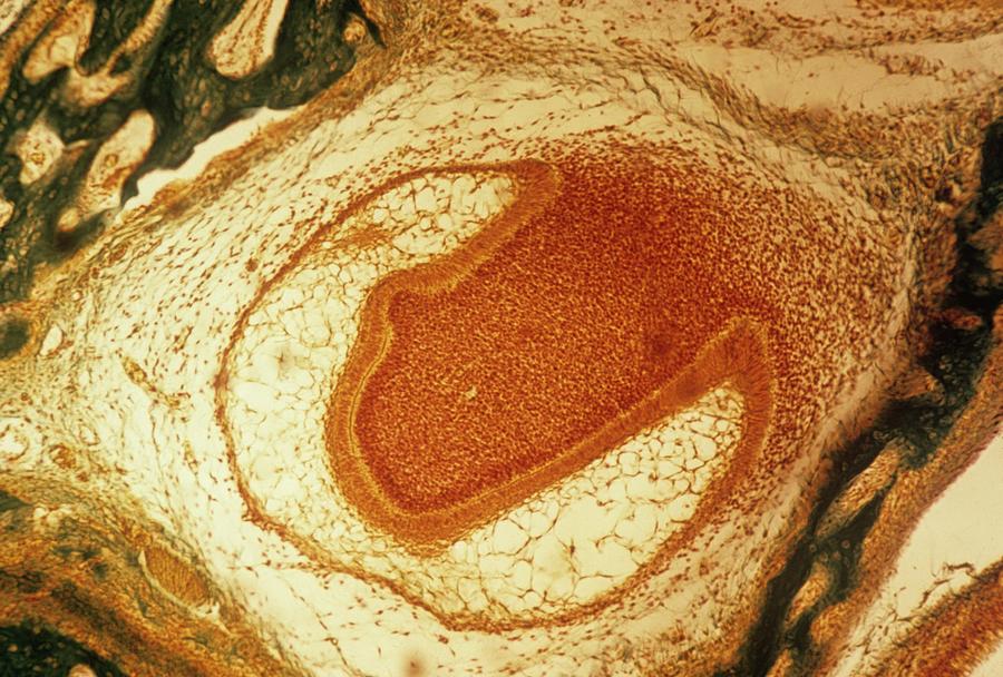 Tooth Bud by Cnri / Science Photo Library