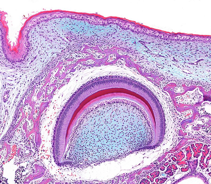 Tooth Photograph by Microscape - Fine Art America