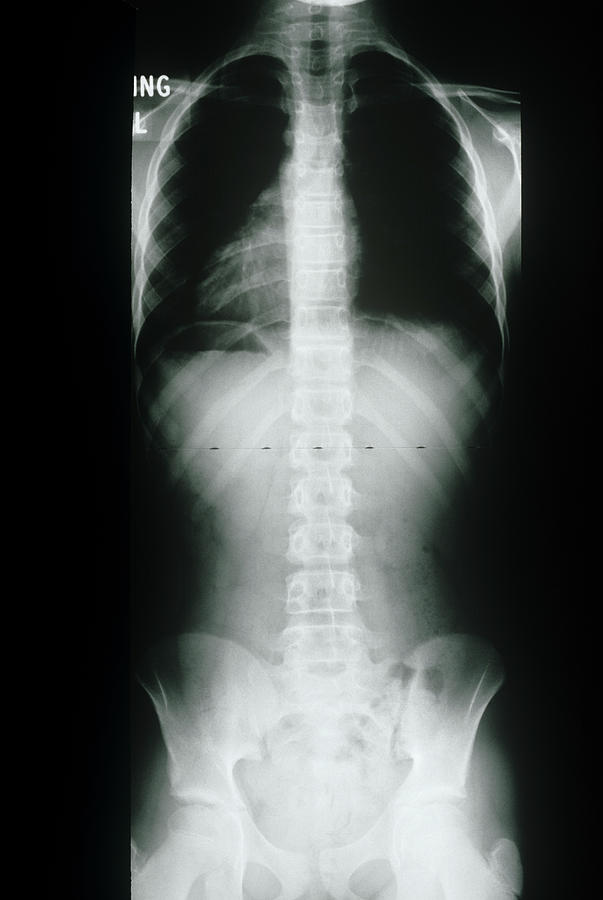 Torso by Mike Devlin / Science Photo Library