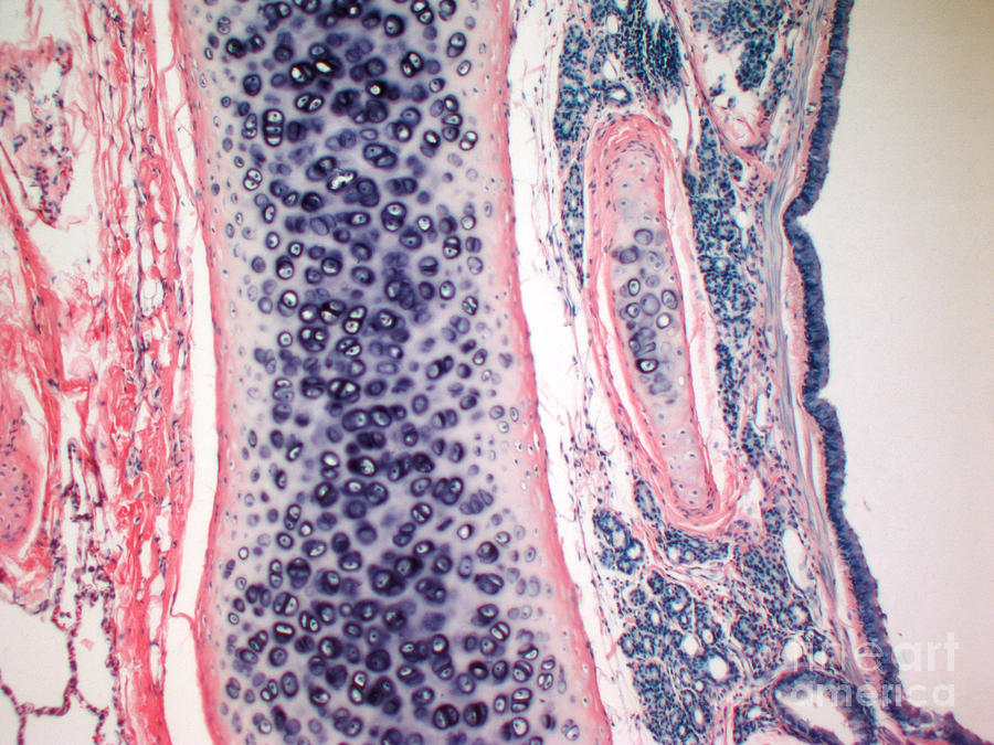 Trachea Photograph by David M. Phillips - Fine Art America