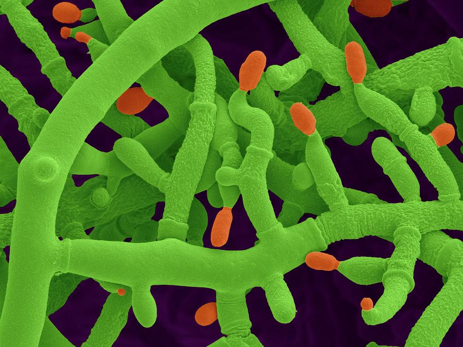 Trichoderma Citrinoviride Endophytic Fungus Photograph by Science Photo Library - Pixels