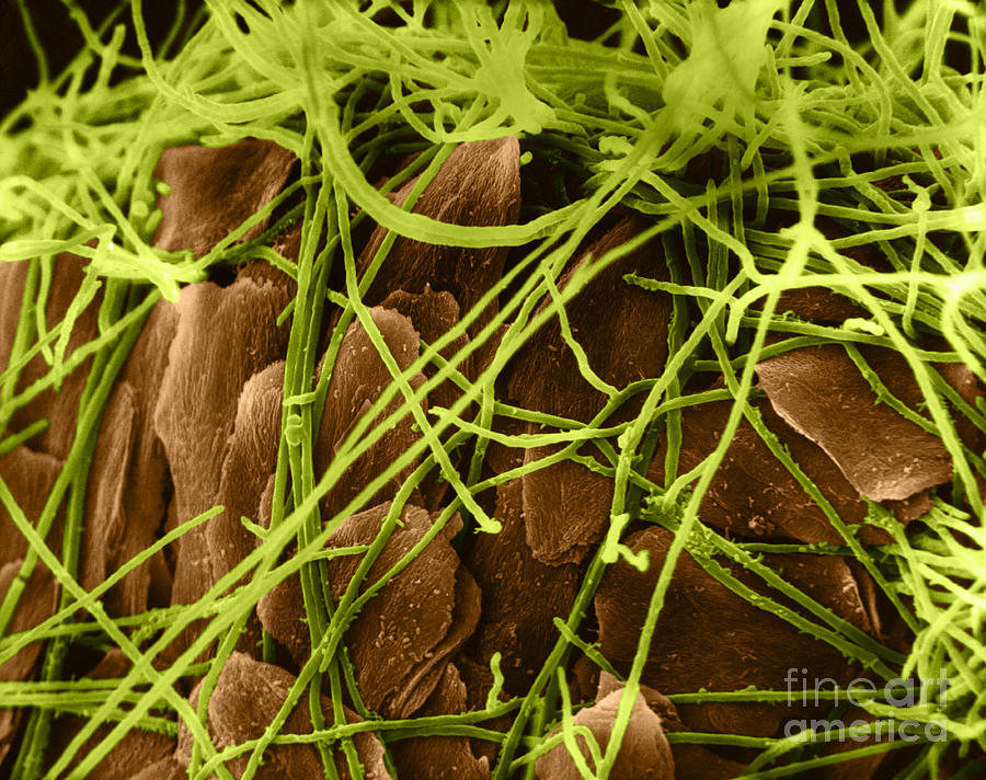 Trichophyton Fungus, Sem Photograph by David M. Phillips - Pixels
