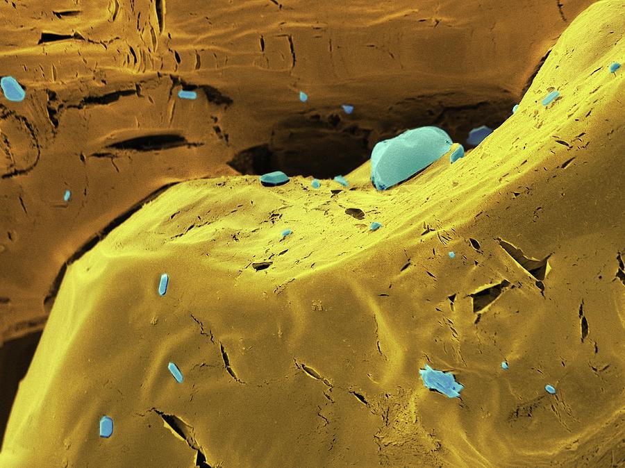 Urea Photograph by Martin Oeggerli/science Photo Library