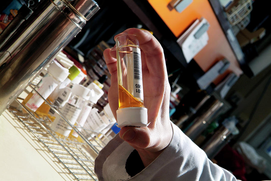 Urine Testing Photograph by Science Photo Library - Pixels