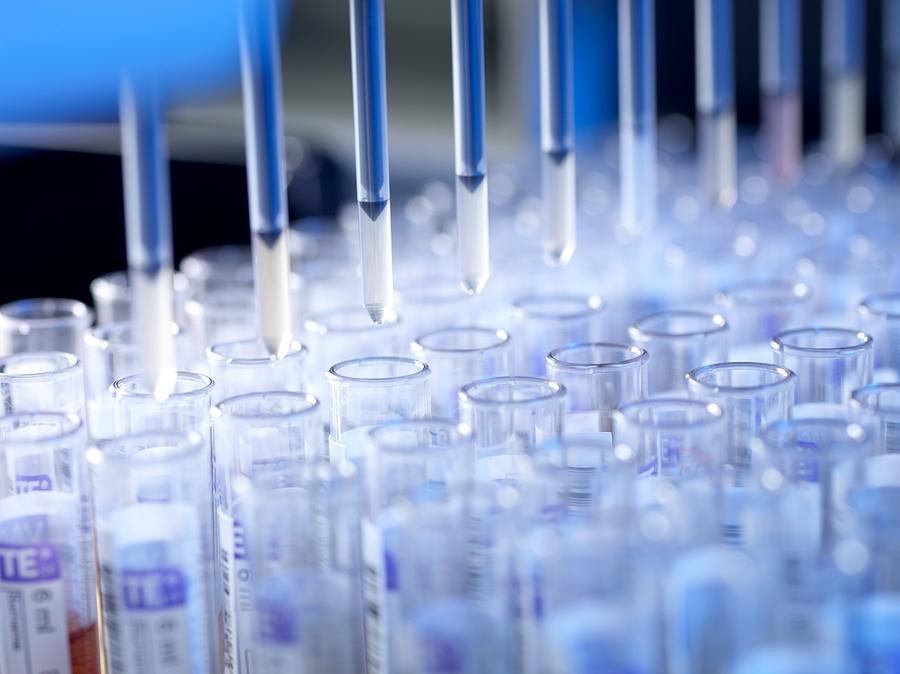 Automated Blood Sample Testing #1 by Science Photo Library