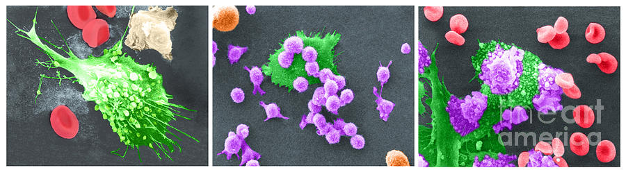 Cancer Cell Death Sequence, Sem #1 by Science Source