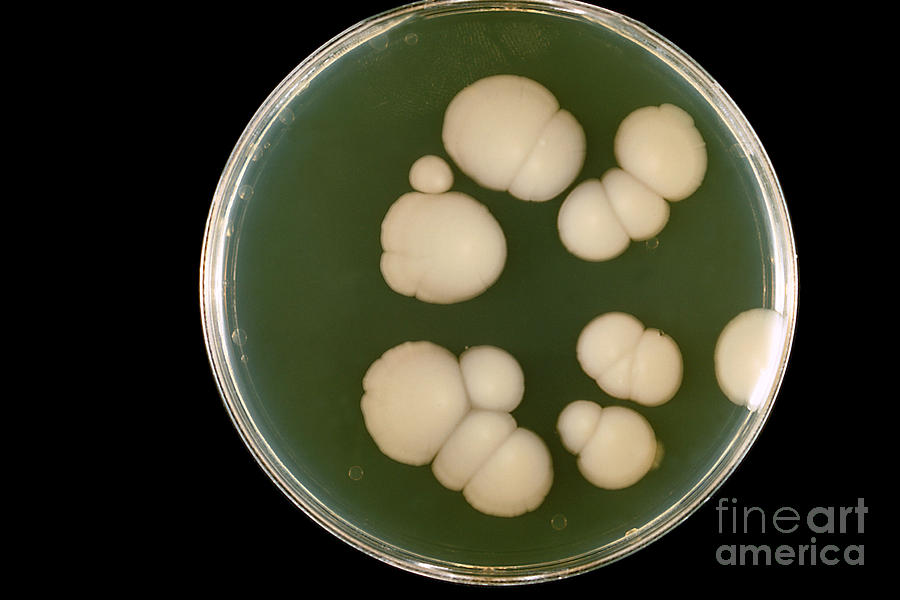 Candida Albicans Photograph by Science Source - Fine Art America