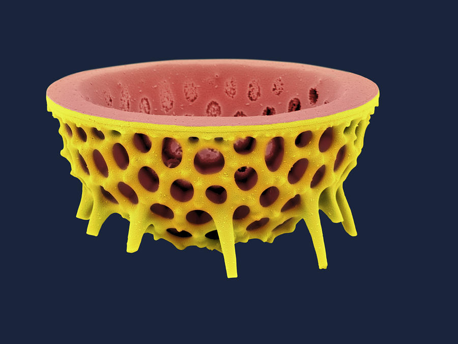 Diatom, Sem #1 by Science Photo Library