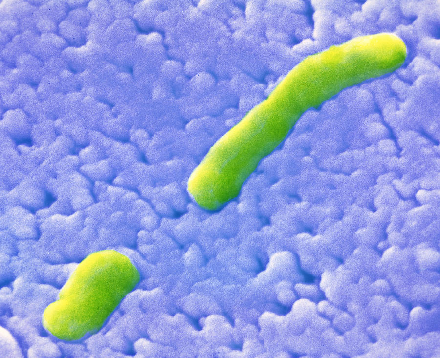 Haemophilus Influenzae Bacteria Photograph by Cnri - Fine Art America