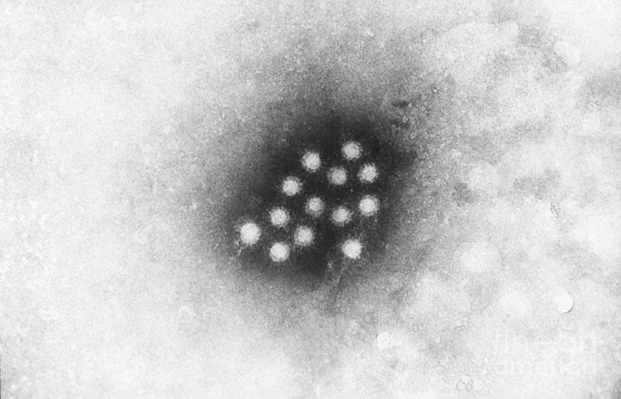 Hepatitis A Virus, Tem #1 by Science Source