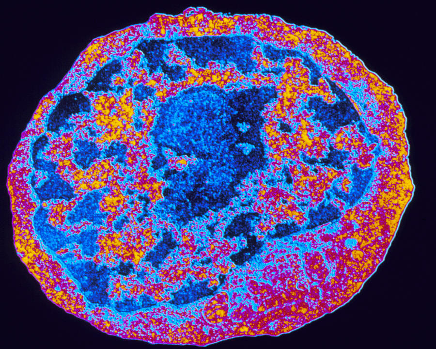 Lactococcus Lactis Bacterium #1 by Science Photo Library