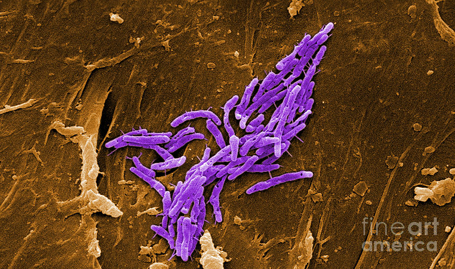 Mycobacterium Fortuitum Photograph by Science Source | Fine Art America