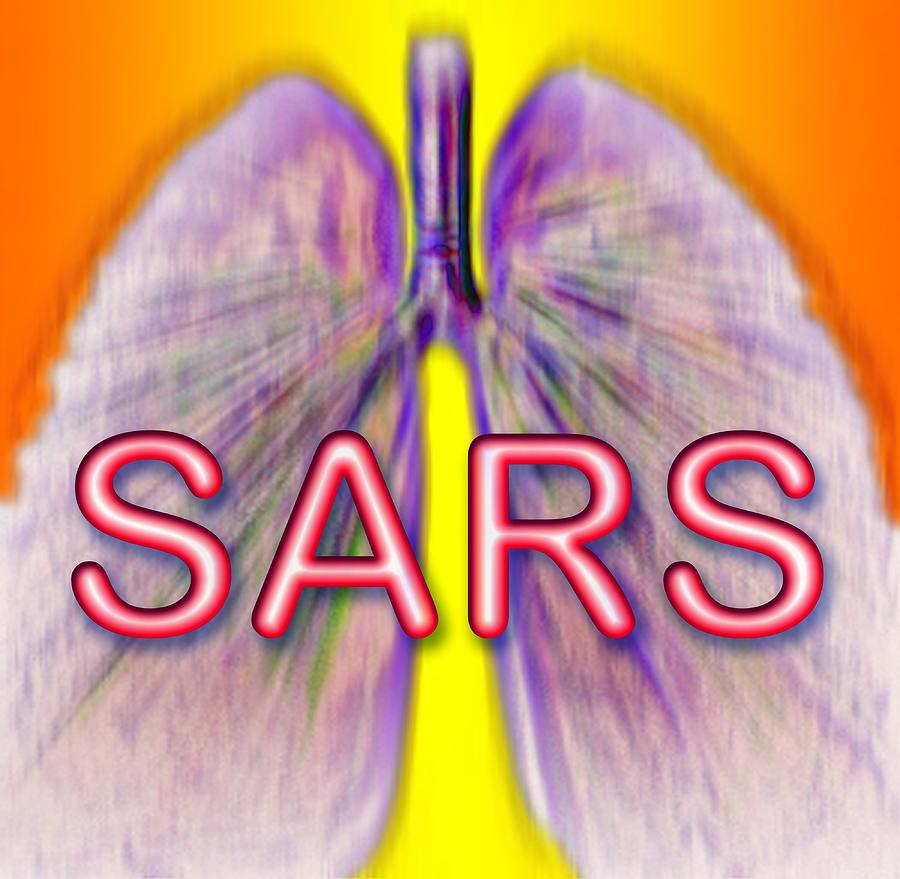 Severe Acute Respiratory Syndrome (sars) Photograph by Pasieka - Fine Art America