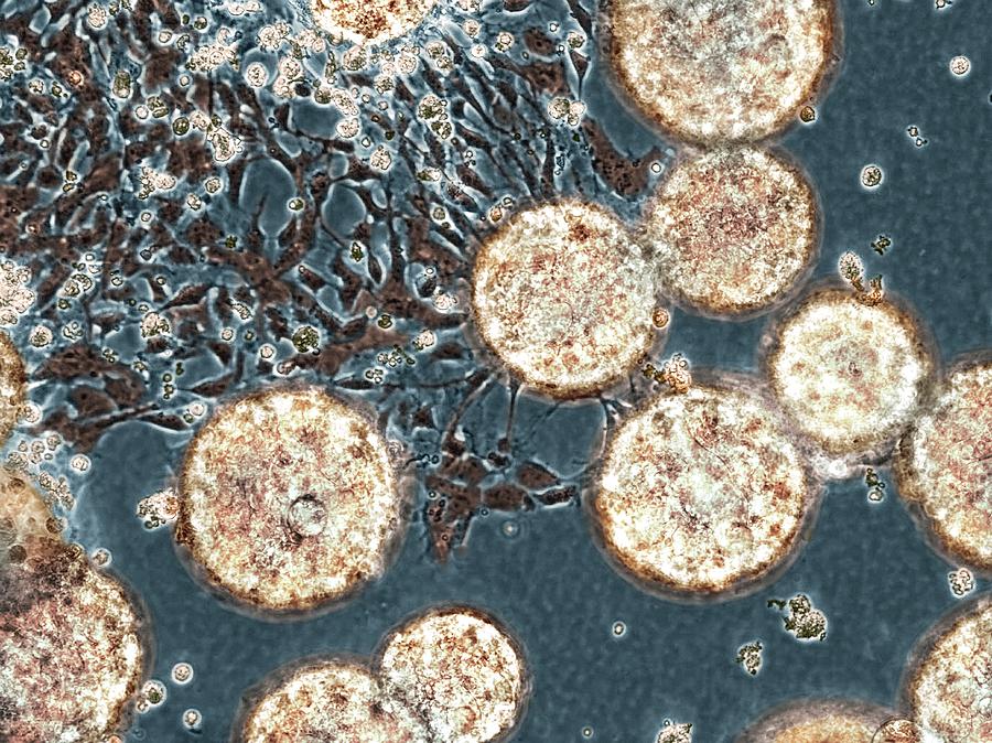 Stem Cells, Light Micrograph #1 by Science Photo Library