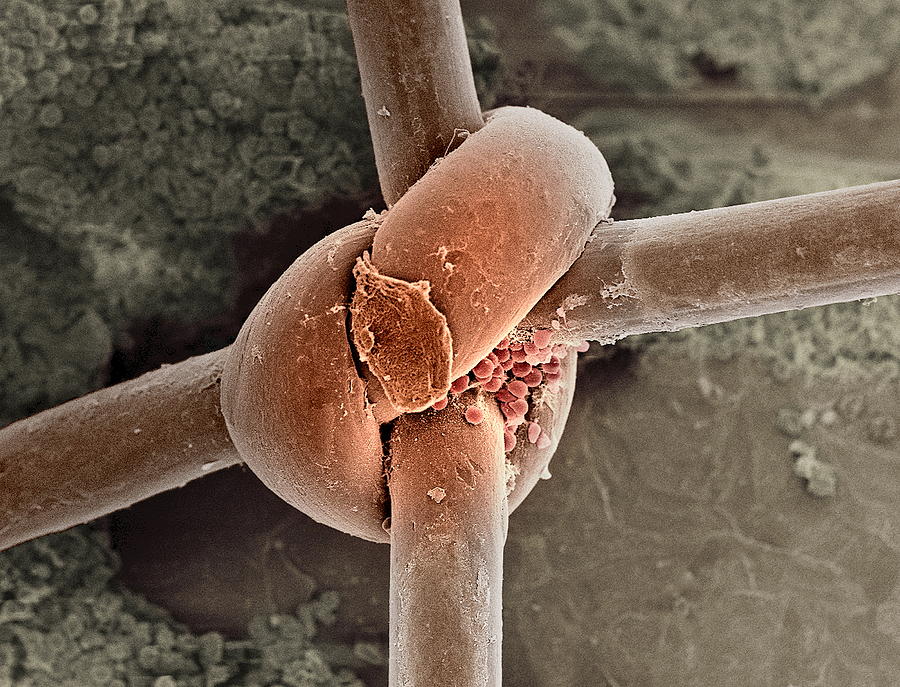 Surgical Thread, Sem #1 by Science Photo Library