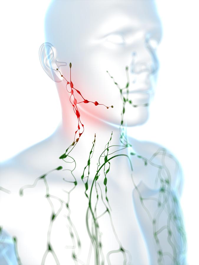 Swollen Lymph Nodes, Artwork Photograph by Sciepro - Pixels