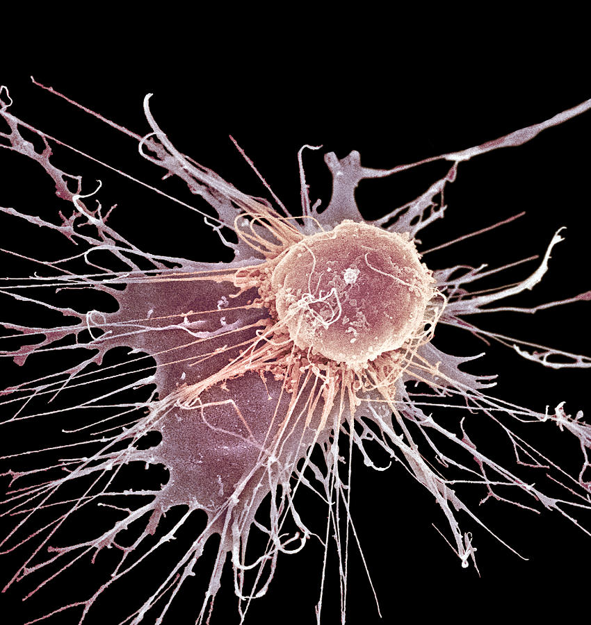 Stem Cell, Sem #10 by Science Photo Library