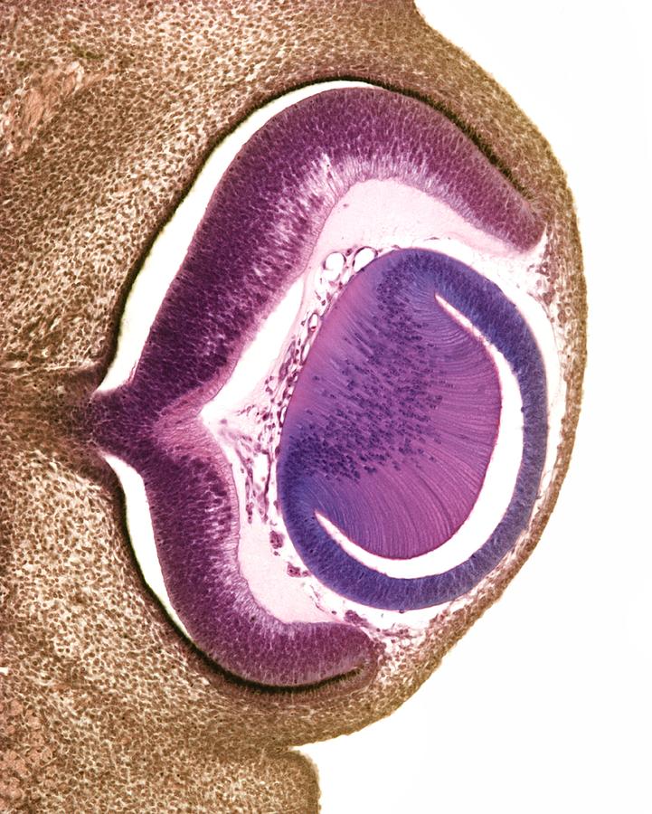 Developing Pig Eye, Light Micrograph Photograph by Steve Gschmeissner ...