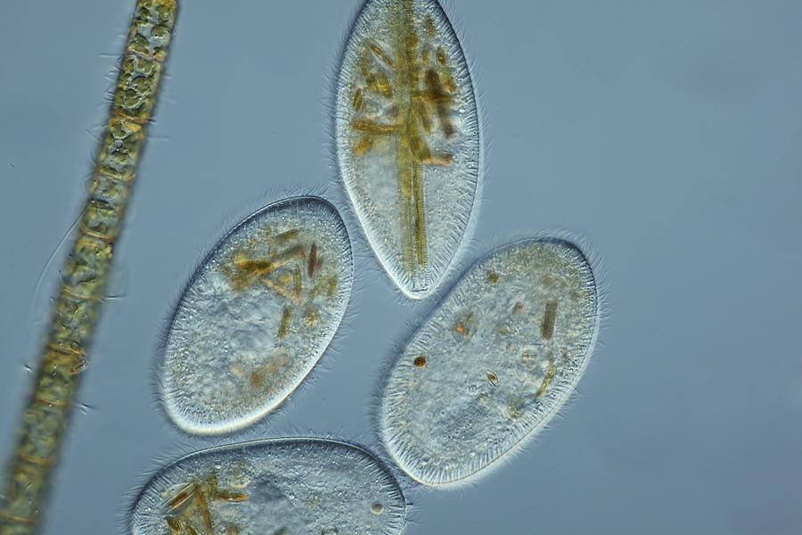 Frontonia Protozoa, Light Micrograph #2 by Frank Fox / Science Photo ...