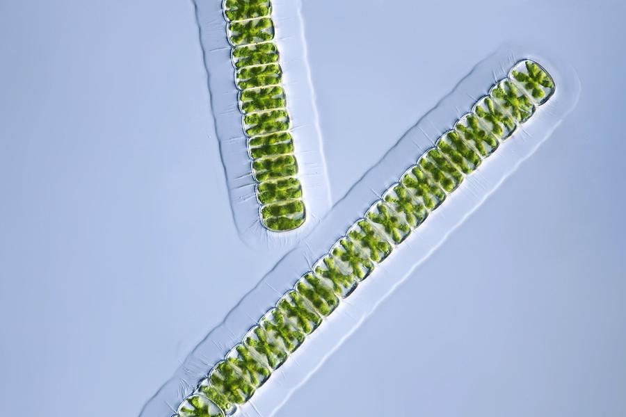 Green Algae, Light Micrograph #2 by Science Photo Library