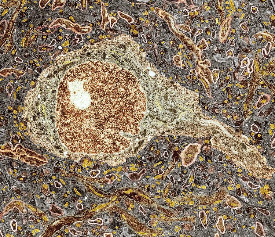 Hippocampus Neuron, Tem Photograph by Thomas Deerinck, Ncmir - Fine Art ...