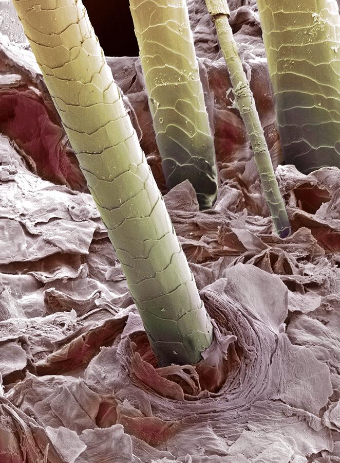 Human Hair, Sem Photograph by Steve Gschmeissner - Fine Art America Human Hair, Sem Photograph by Steve Gschmeissner - Fine Art America