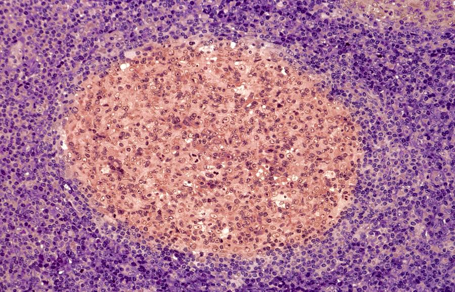 Lymph Node, Light Micrograph #2 by Science Photo Library