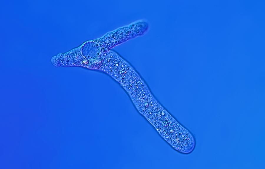 Proteus Amoeba, Light Micrograph #2 by Science Photo Library