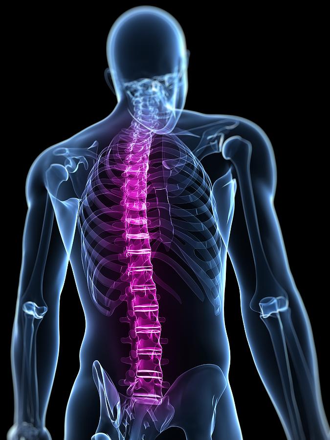 Back Pain, Conceptual Artwork Photograph by Sciepro - Fine Art America