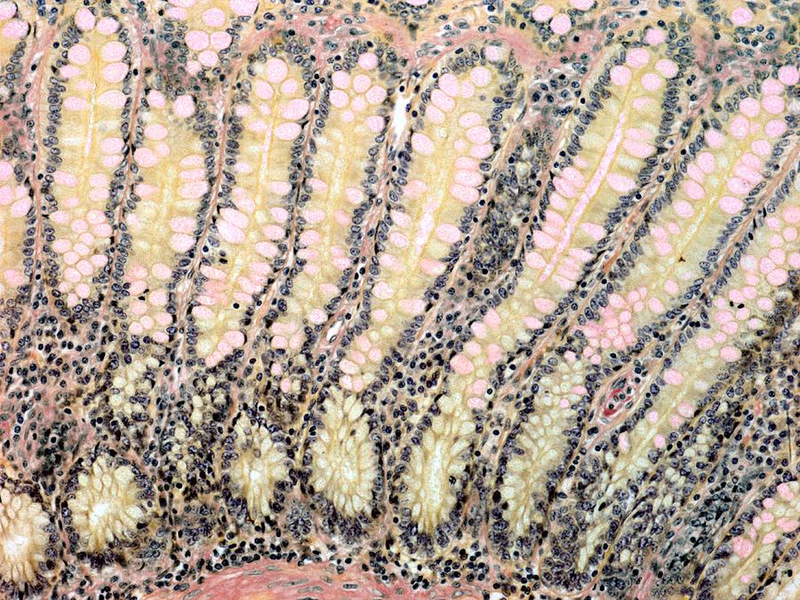 Colon Lining, Light Micrograph Photograph by Steve Gschmeissner