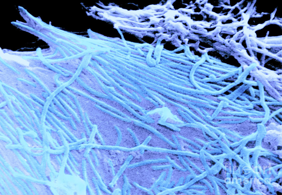 Ebola Virus, Sem Photograph by Science Source - Fine Art America