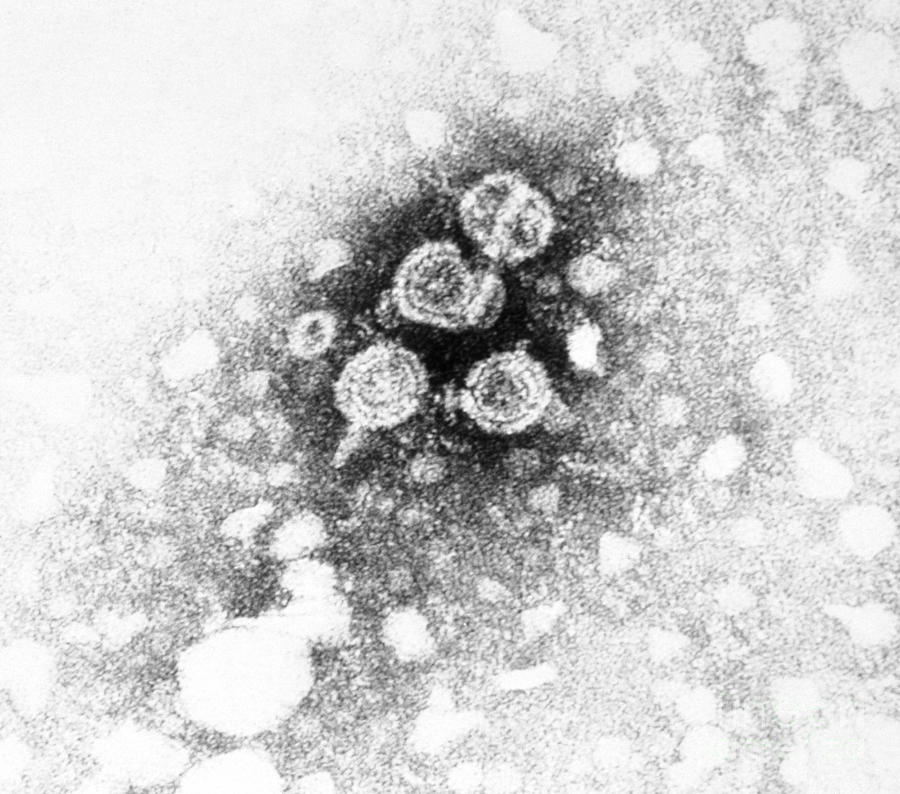 Hepatitis B, Tem Photograph by Science Source - Fine Art America