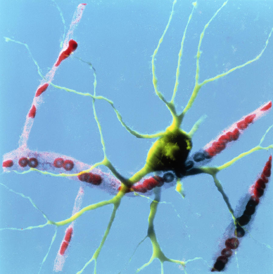 Nerve Cell #3 by David Becker / Science Photo Library