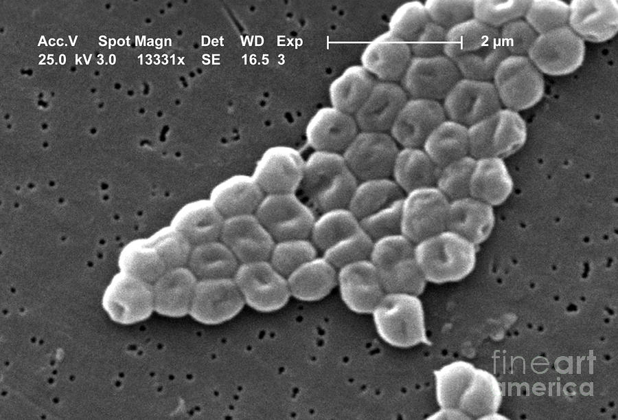 Acinetobacter Baumannii, Sem Photograph by Science Source - Fine Art ... Acinetobacter Baumannii, Sem Photograph by Science Source - Fine Art ...