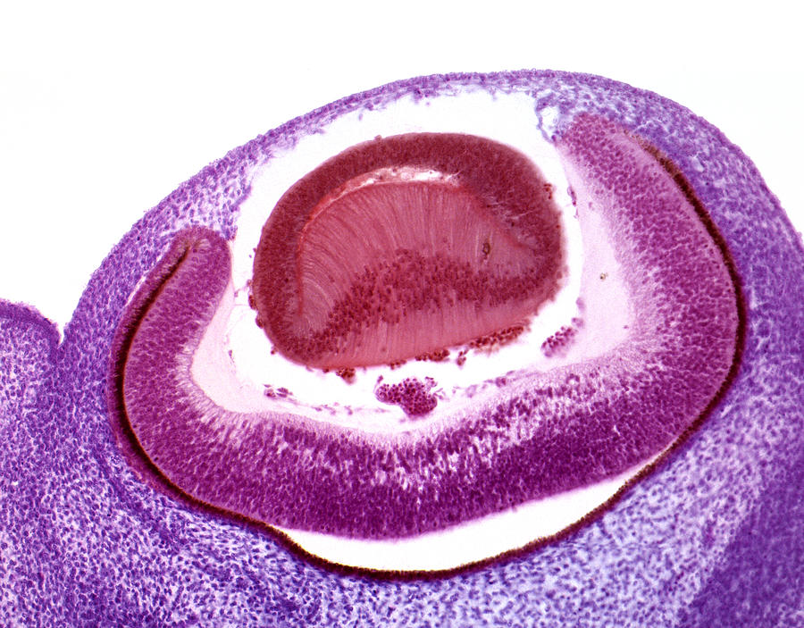 Developing Pig Eye, Light Micrograph Photograph by Steve Gschmeissner ...