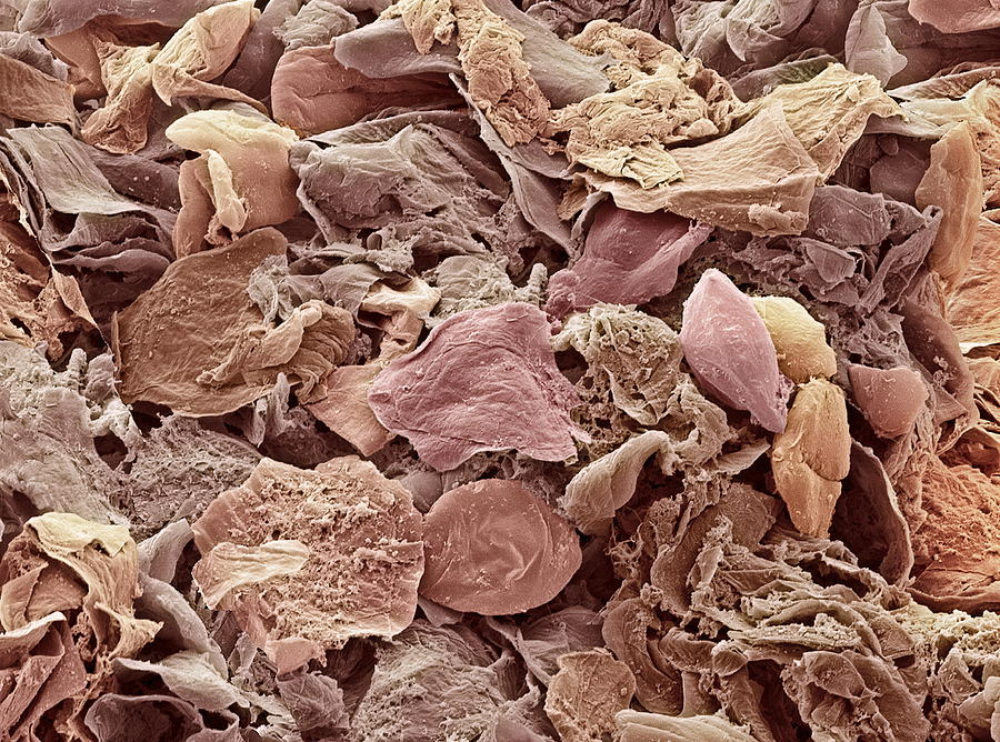 Ear Canal, Sem Photograph by Steve Gschmeissner - Fine Art America