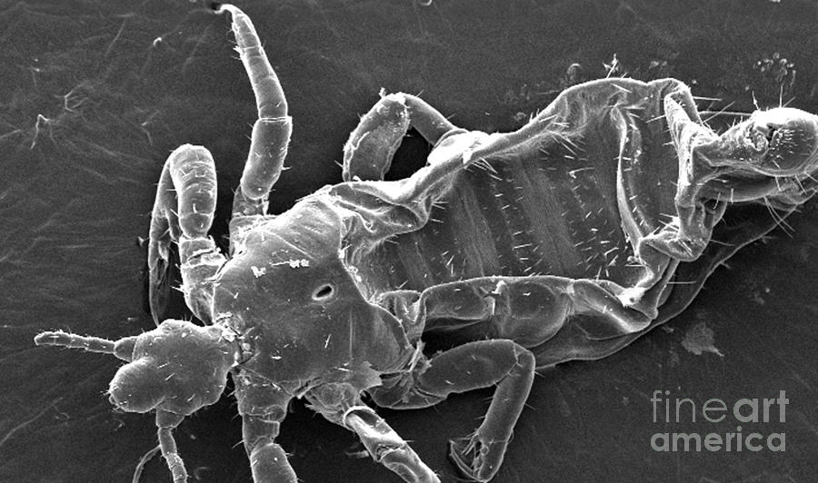 Head Louse Photograph by Science Source | Pixels