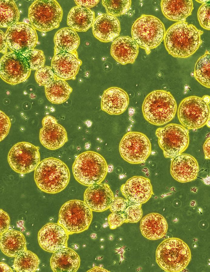 Stem Cells, Light Micrograph #4 by Nibsc / Science Photo Library
