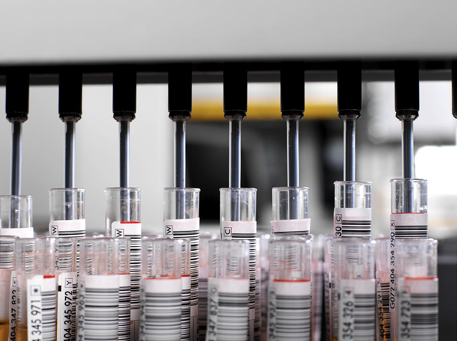 Blood Analysis Photograph by Tek Image - Fine Art America