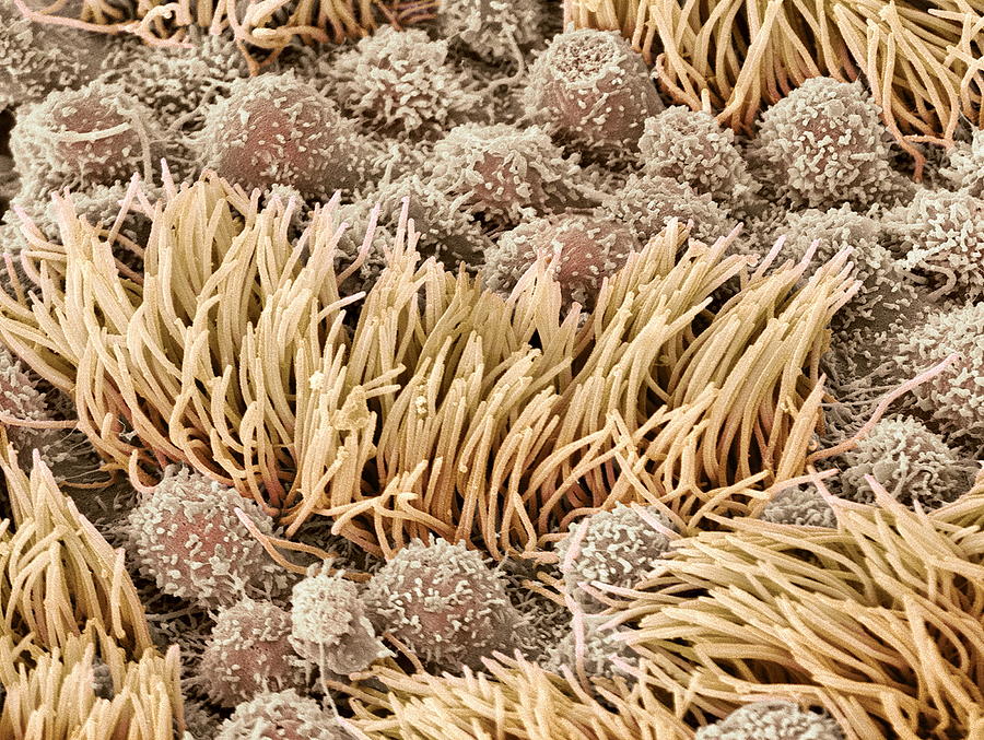 Fallopian Tube, Sem Photograph by Steve Gschmeissner - Fine Art America